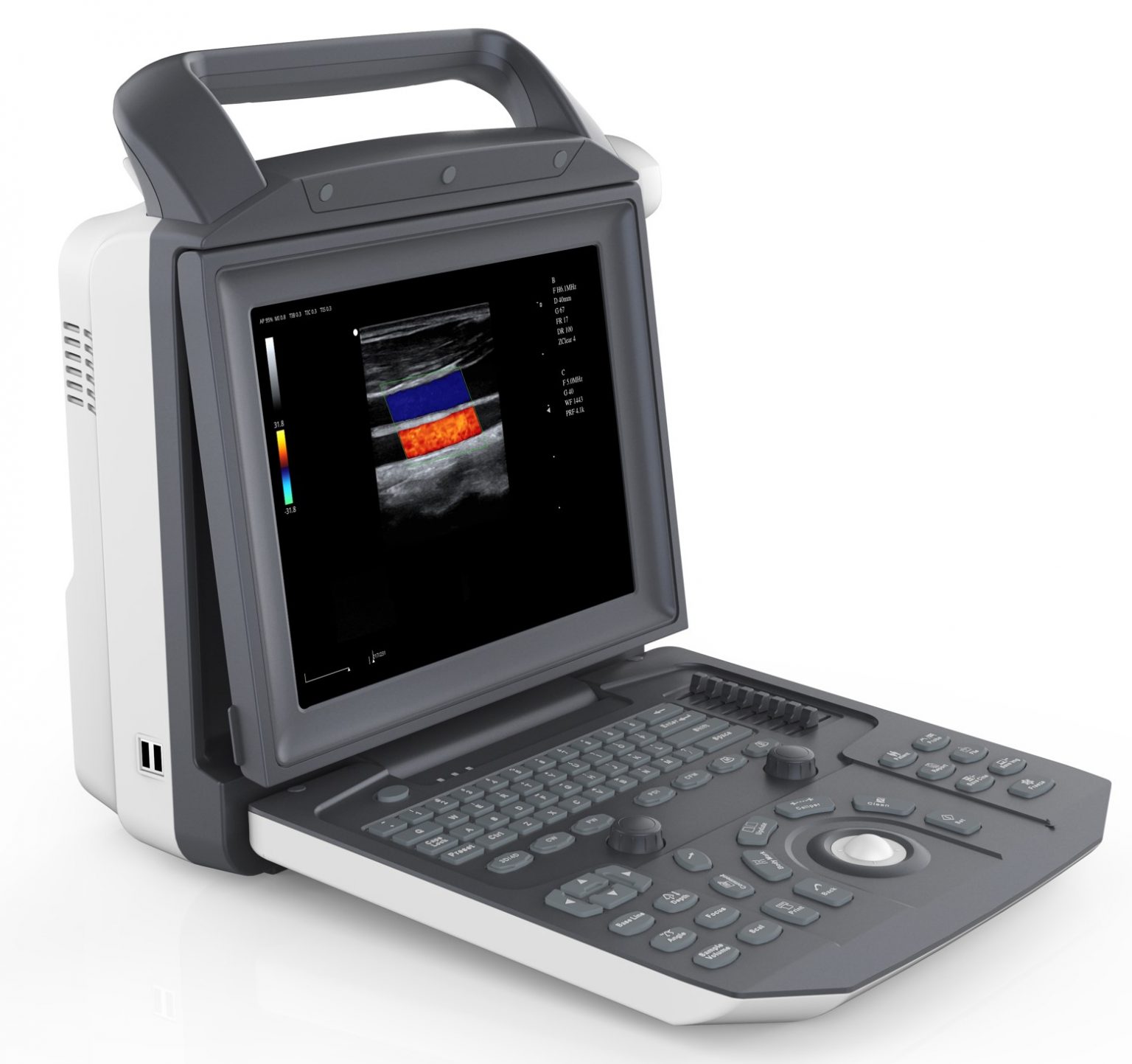 SALE - ZONCARE Colour Doppler Ultrasound System - Adelaide EasiMed